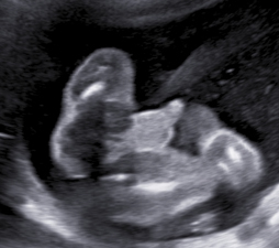 Gender scan - PROFEMA